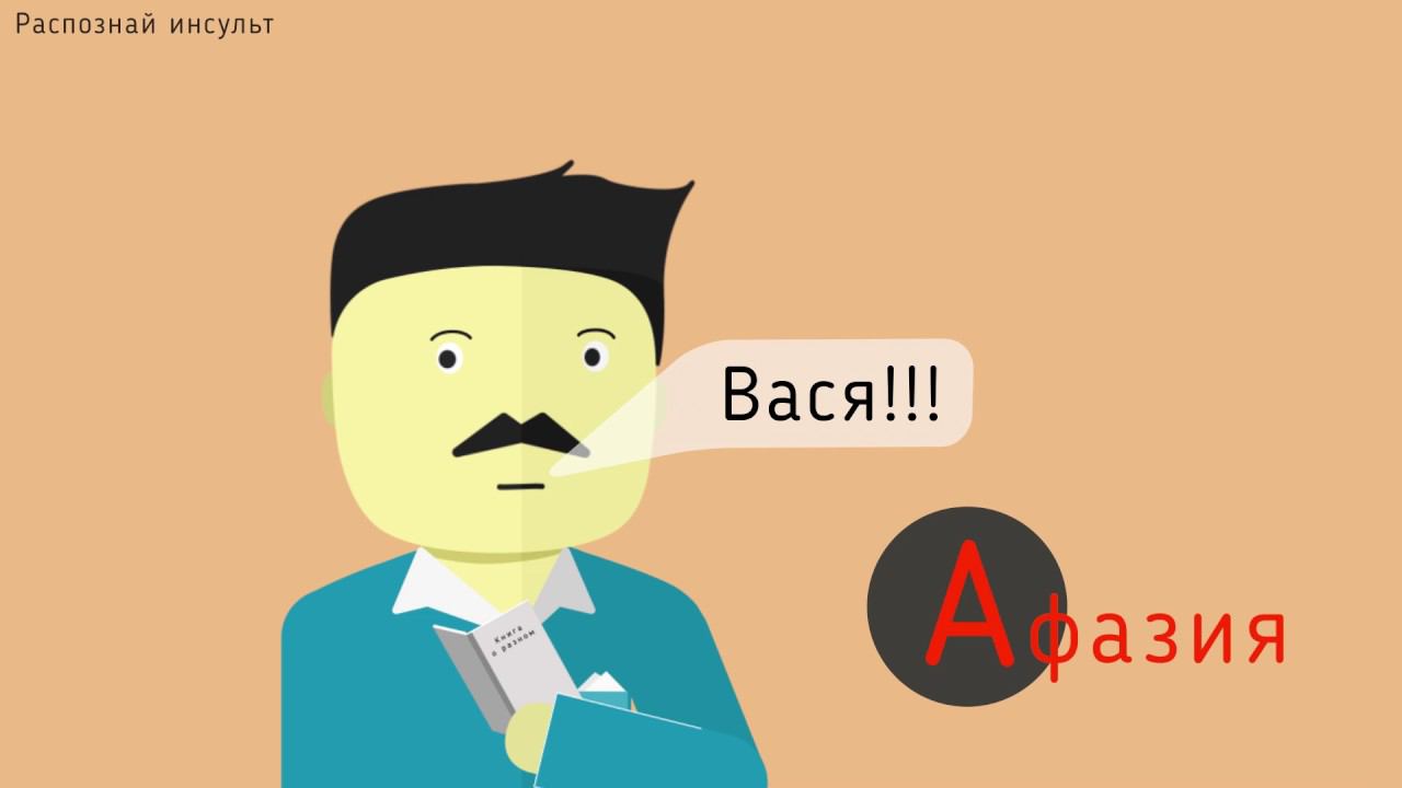 Признаки инсульта УДАР