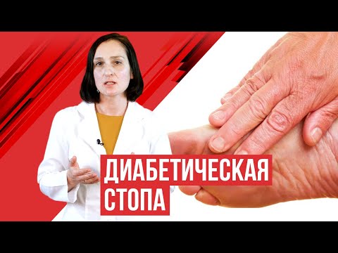 Диабетическая стопа определение и профилактика