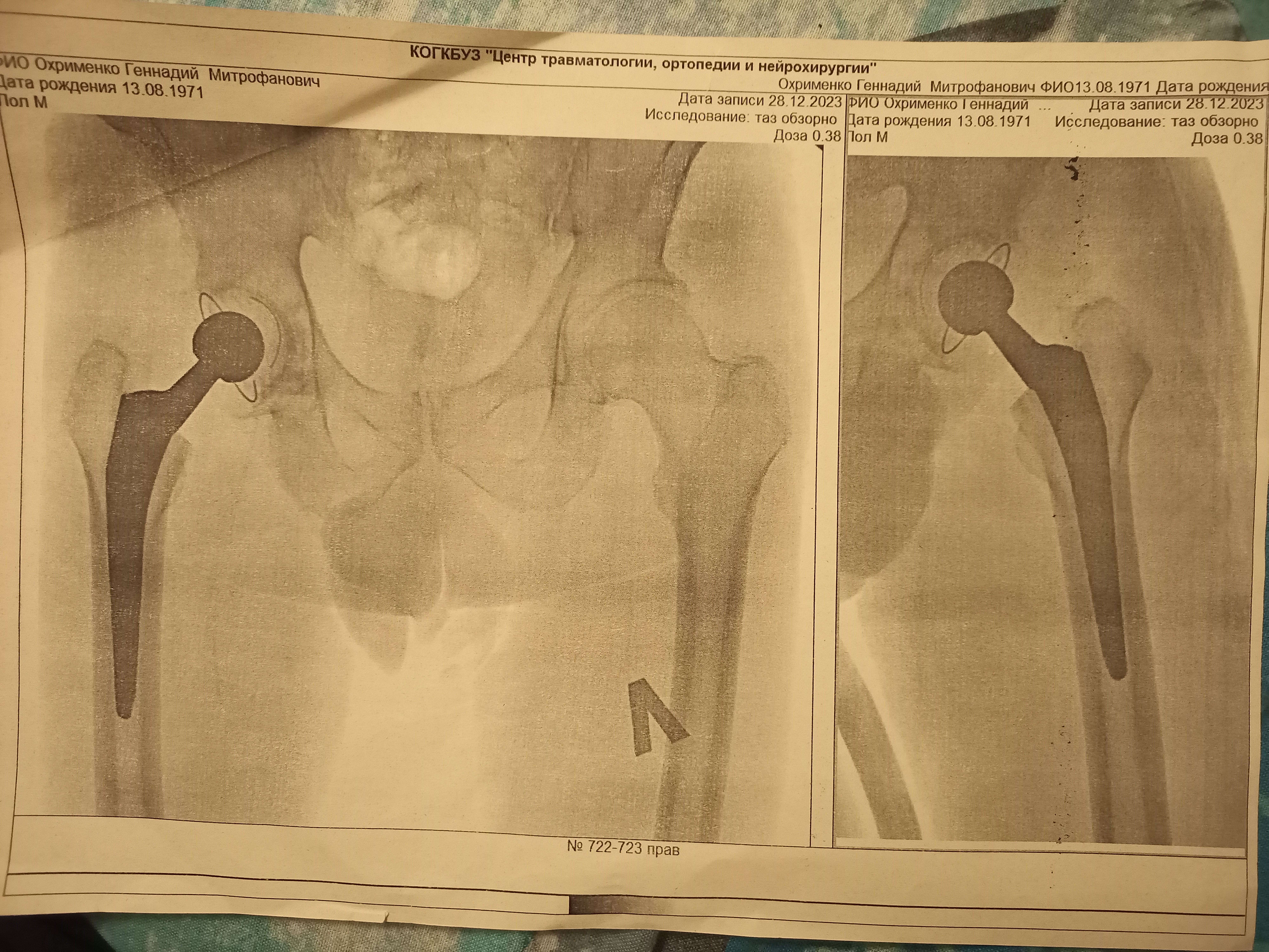 3 дня после замены ТБС и Вы здоровы.