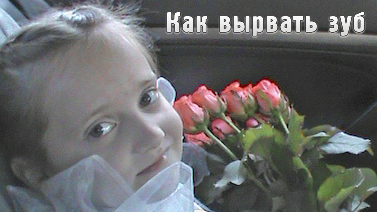 Как вырвать зуб