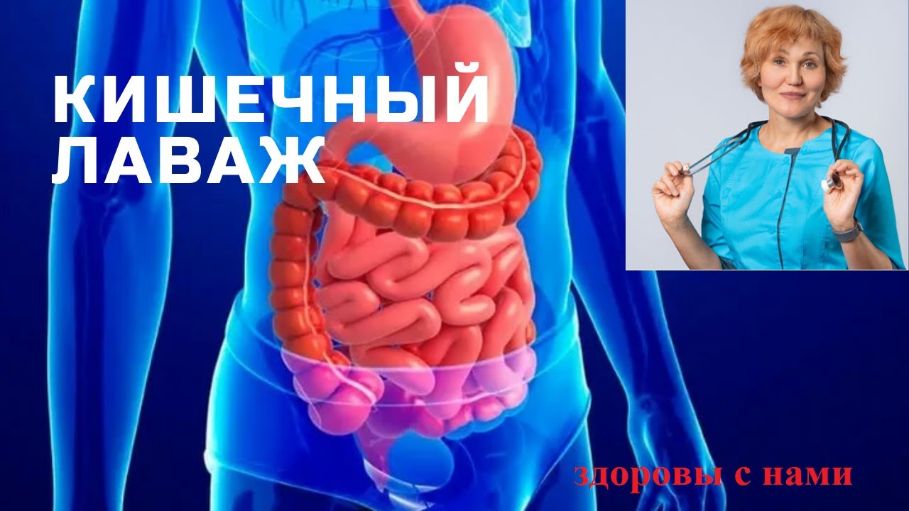 Кишечный лаваж - практические рекомендации..mp4