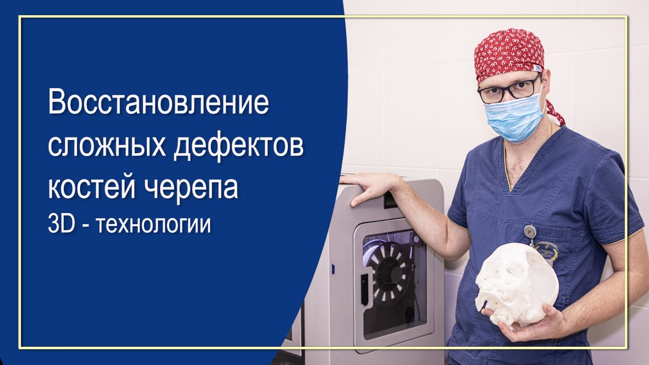 Восстановление сложных дефектов костей черепа. 3D - технологии