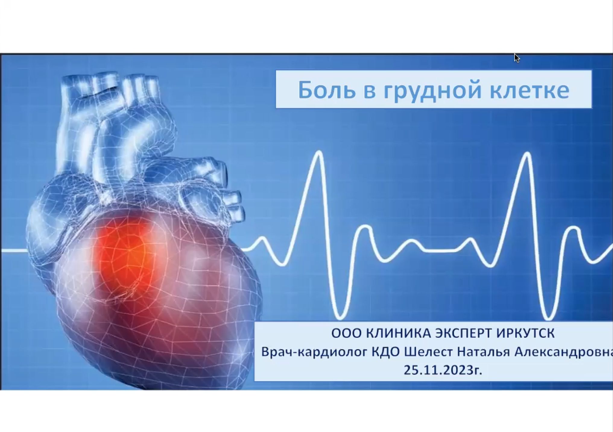 Шелест Наталья Александровна. Боль в грудной клетке. 25.11.2023.