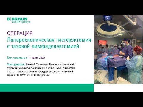 Лапароскопическая гистерэктомия с тазовой лимфаденэктомией | А.С. Шевчук