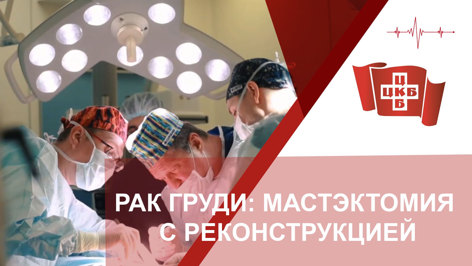 Рак груди: Мастэктомия с реконструкцией