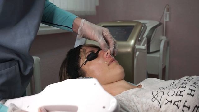 Удаление Винного Пятна На Лице