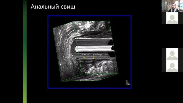 Вебинар по продукции BK Medical, колопроктология (30.04.2020)