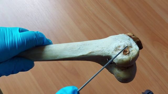 Кости нижней конечности