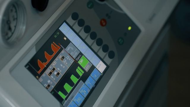 Трансцервикальная гистероскопическая резекция субмукозного узла миомы матки