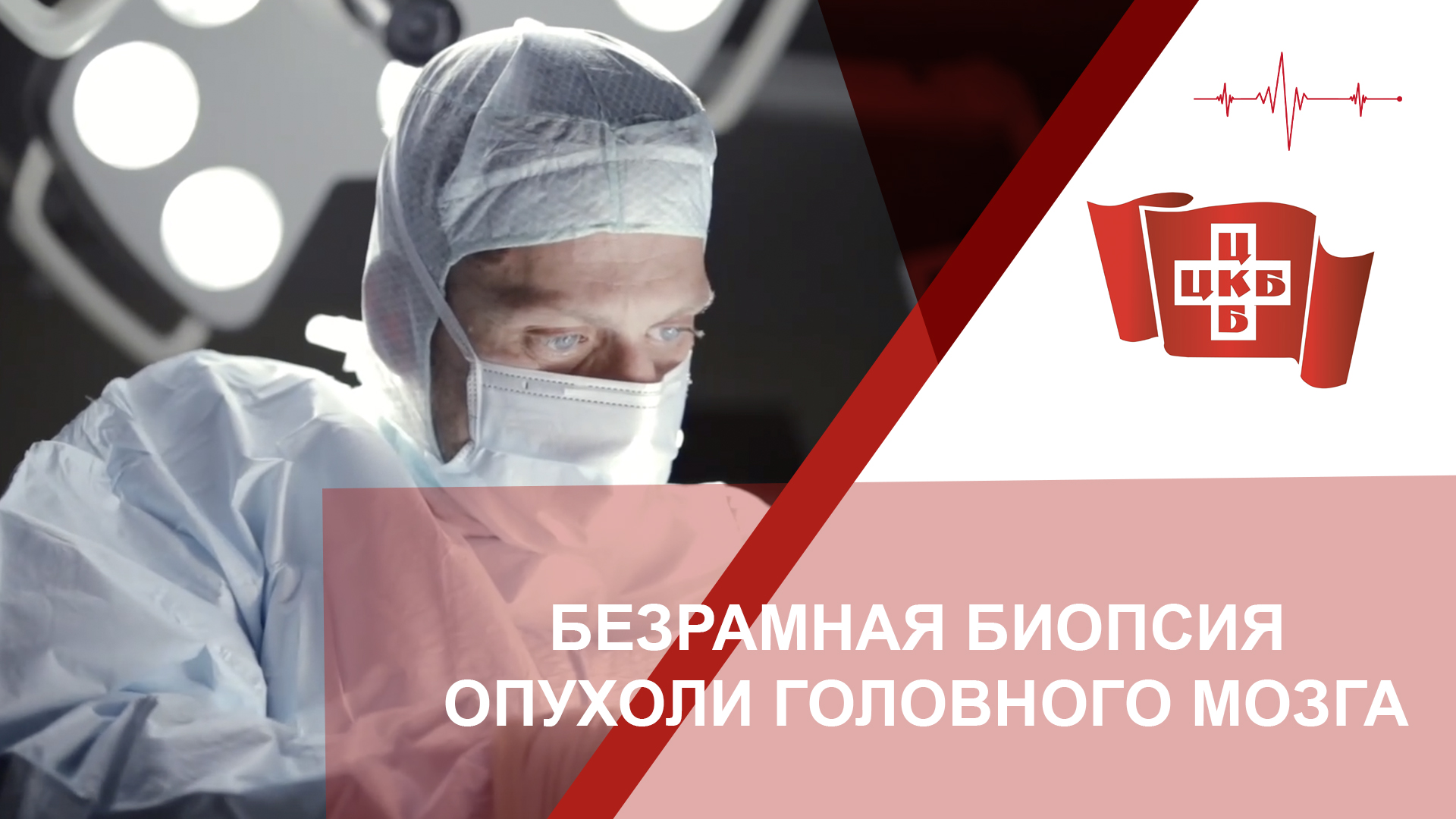 Безрамная биопсия опухоли головного мозга