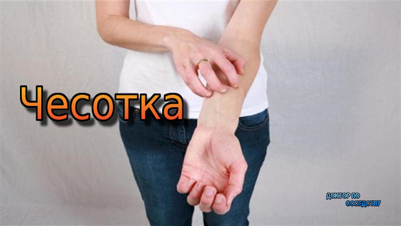 Чесотка. Доктор по соседству.