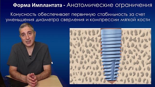 Различия между имплантатами или Чем отличаются импланты (форма)