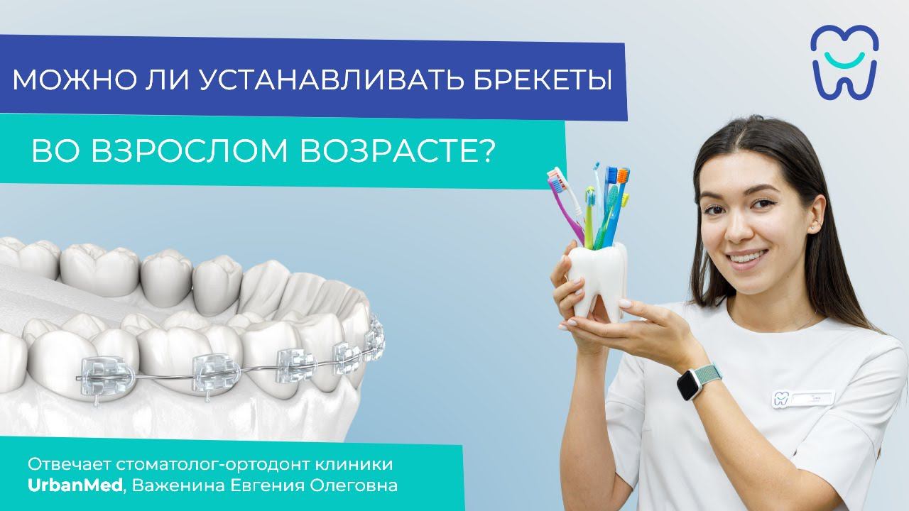 Можно ли установить брекеты во взрослом возрасте?