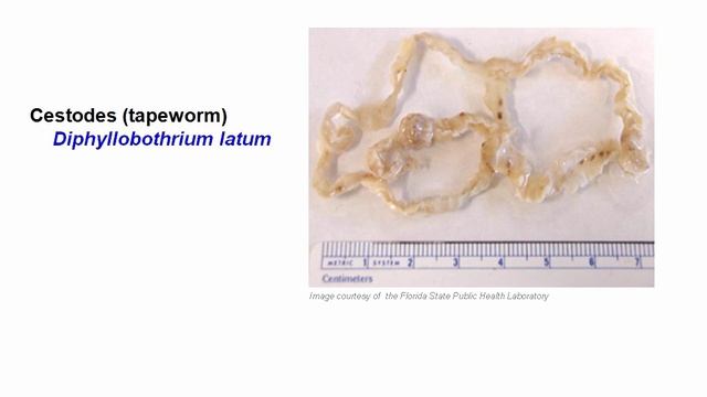 USMLE RX - 7.Микробиология - 5.Паразитология - 7.Цестоды (ленточные черви)