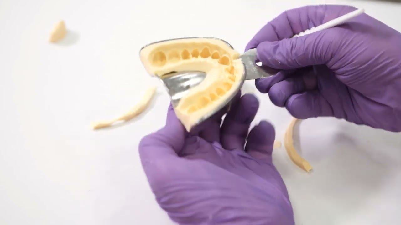 Двухэтапная техника получения оттиска.  Первичный оттиск с помощью   С силикона oxasil Putty