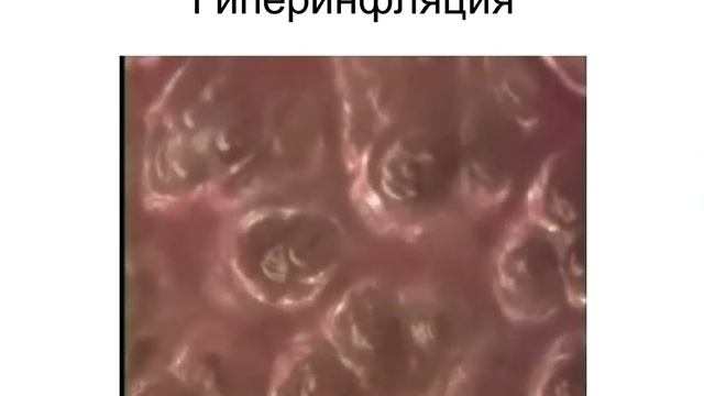 ОРДС Эксперементальные модели Горячев А.С