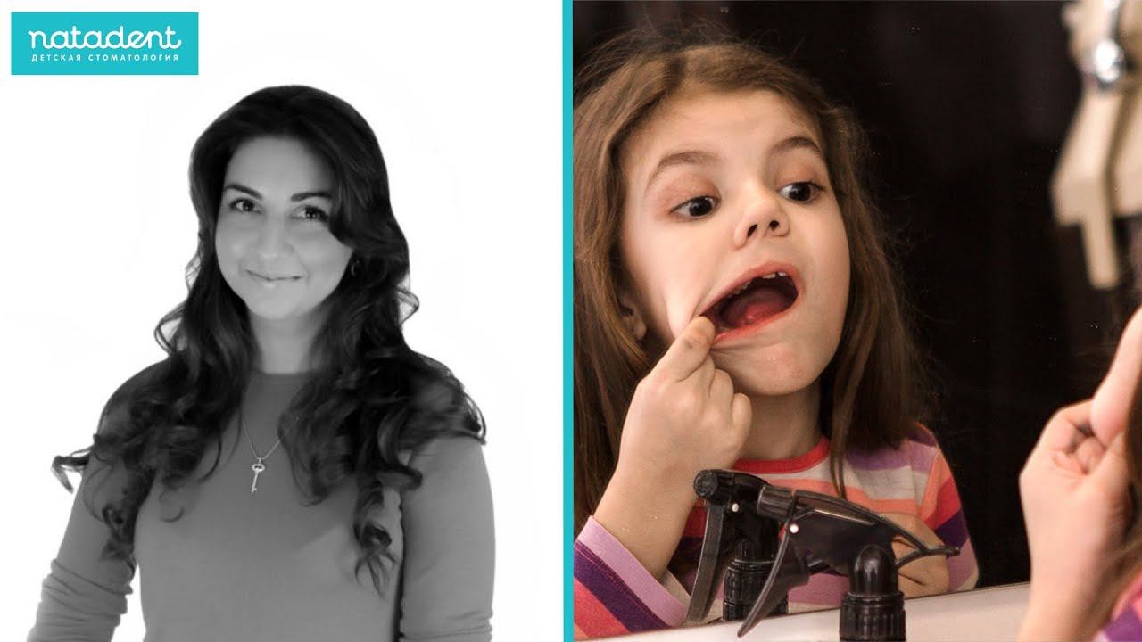 155. Свищ на десне у ребенка