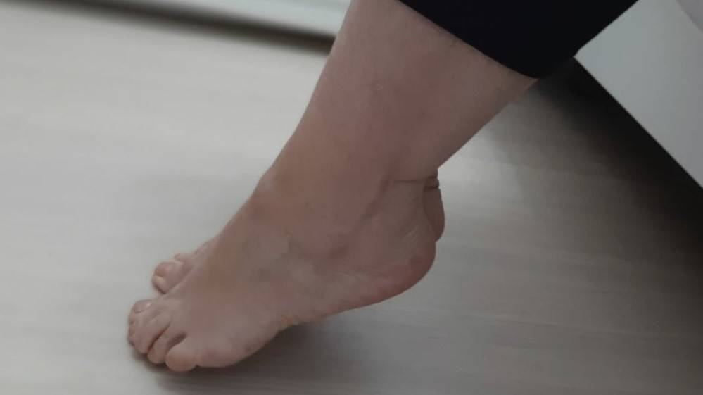 Как легко почистить пятки