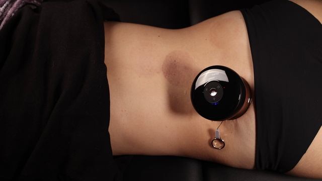 Массаж при болях в спине. Применение динамических вакуумных банок AchedAway Cuppers.