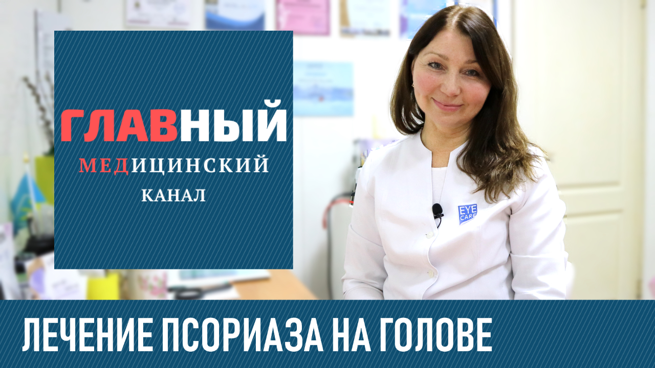 Псориаз на голове. Лечение псориаза на голове в домашних условиях, шампунь и мазь