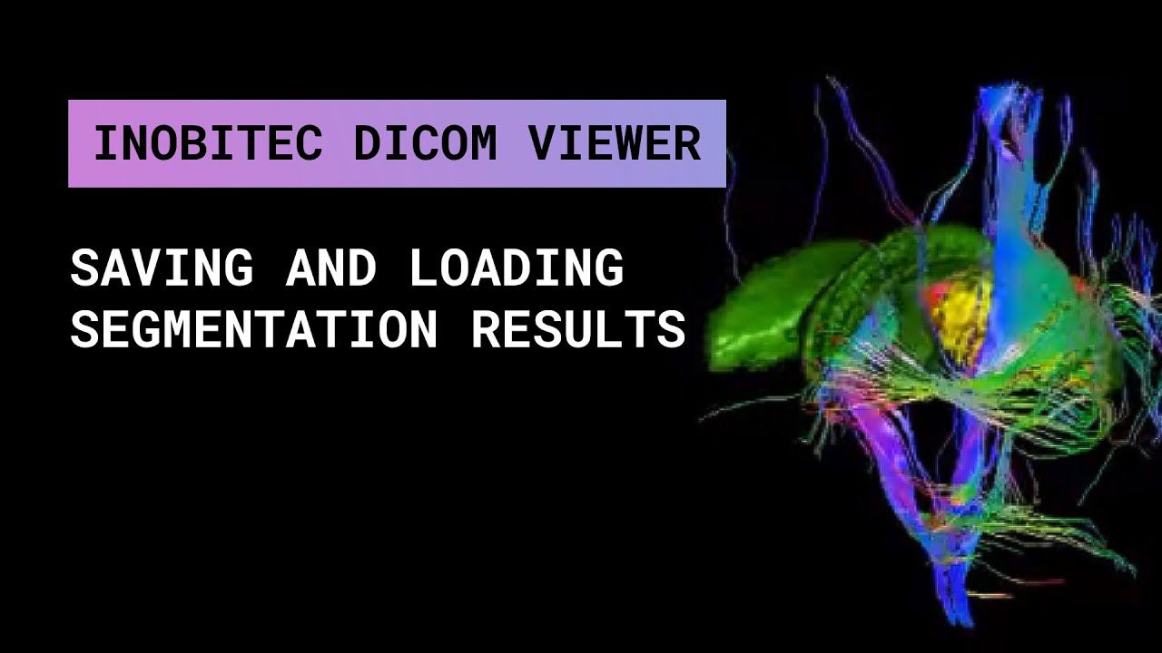 Сохранение и загрузка результатов сегментации