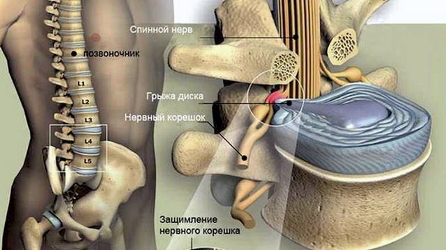 Миофасциальная терапия