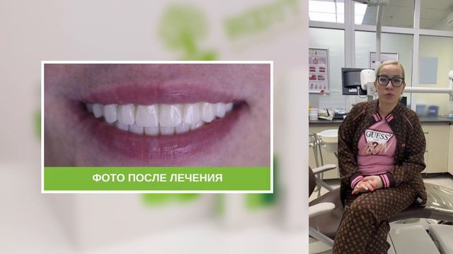 Отзыв о комплексной имплантации зубов