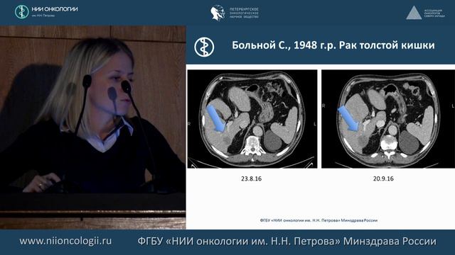 МРТ в выявлении очаговых поражений печени