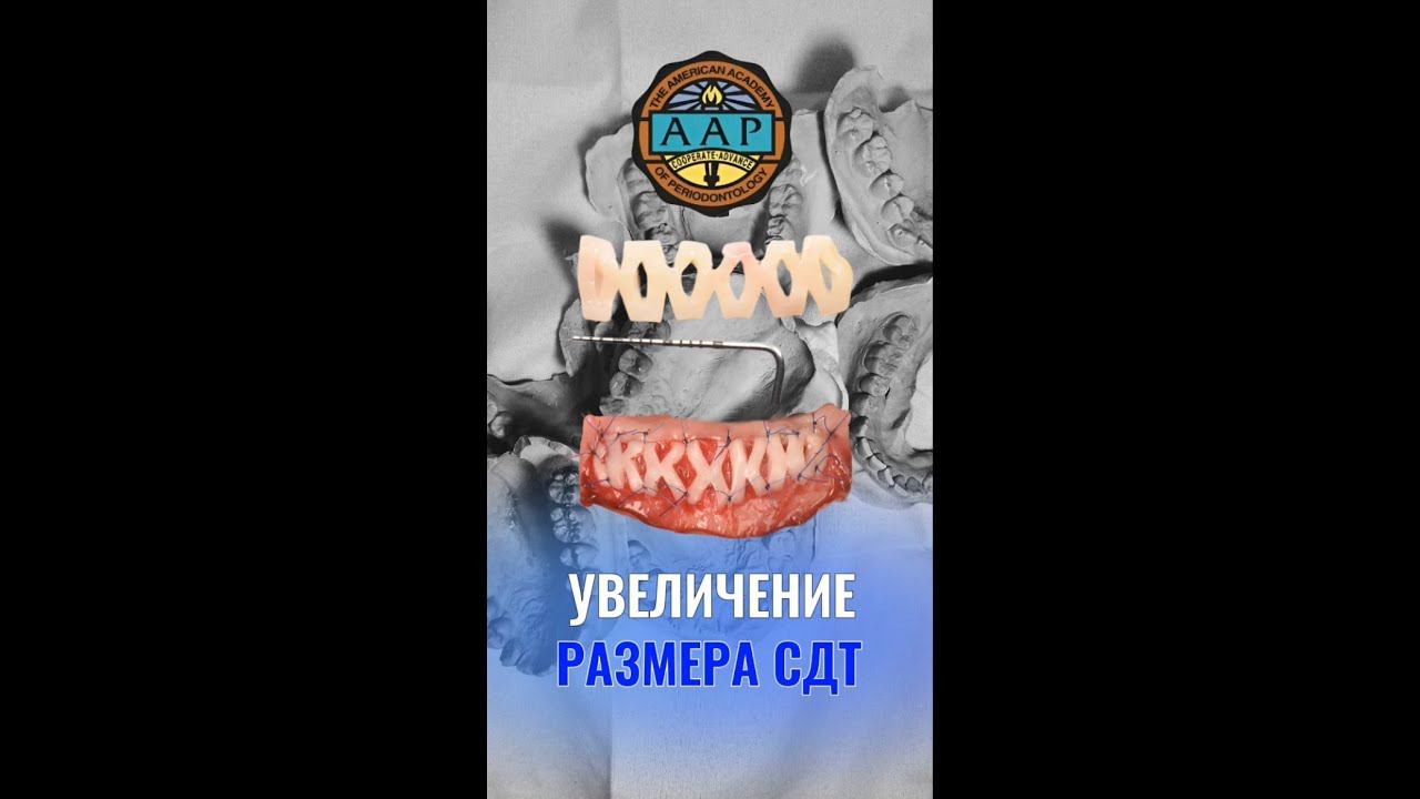 Увеличение длинны СДТ