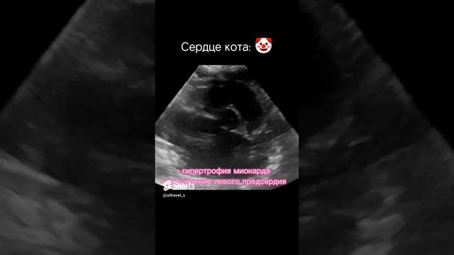 Просто поставь датчик на кота | ЖИЗА | ЭХО коту