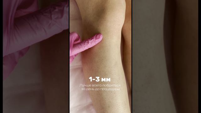 Длина волос перед ЛЭ