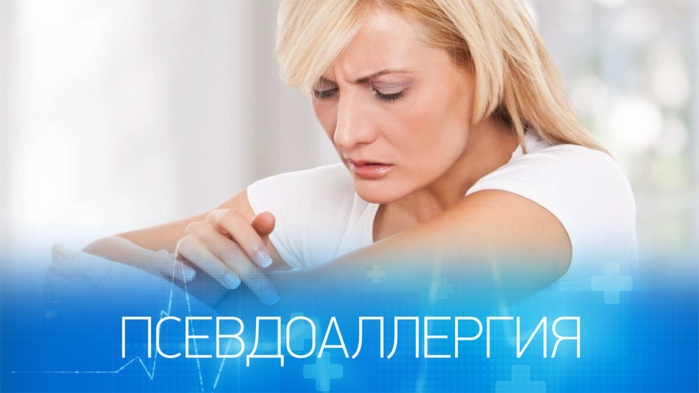 Псевдоаллергия
