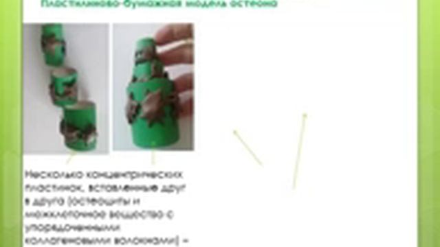 Виды костной ткани. Кость как орган