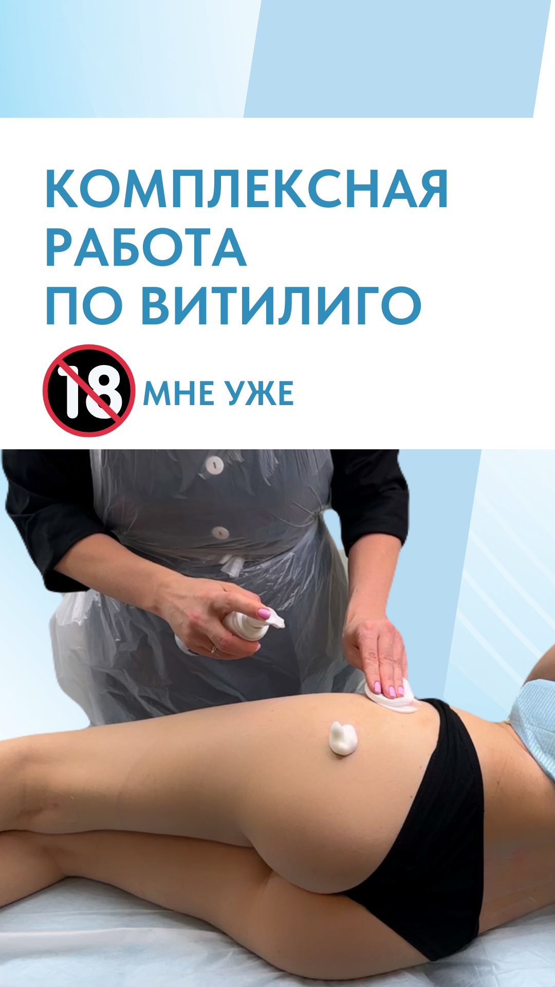 18 МНЕ УЖЕ! С КАКОГО ВОЗРАСТА МОЖНО ЗАКРАШИВАТЬ ПЯТНА ВИТИЛИГО?