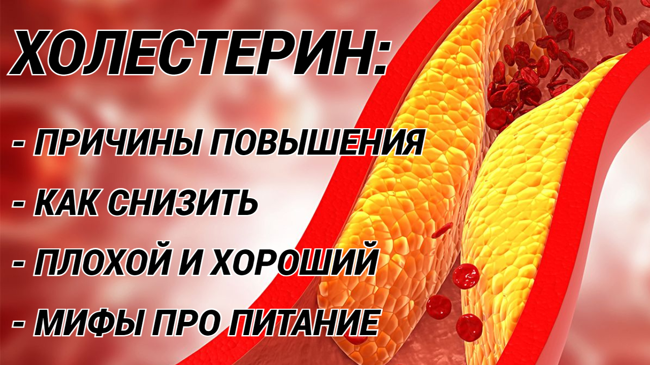 ХОЛЕСТЕРИН: причины повышения, как снизить, как диагностировать и вся правда про хороший и плохой!