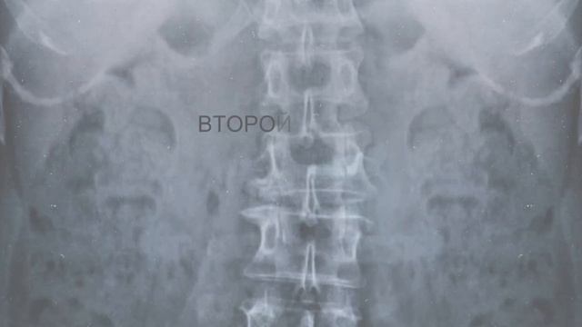 #14 Бальзам для позвоночника. Станислав Лосев_ Отказ от желания радоваться жизни