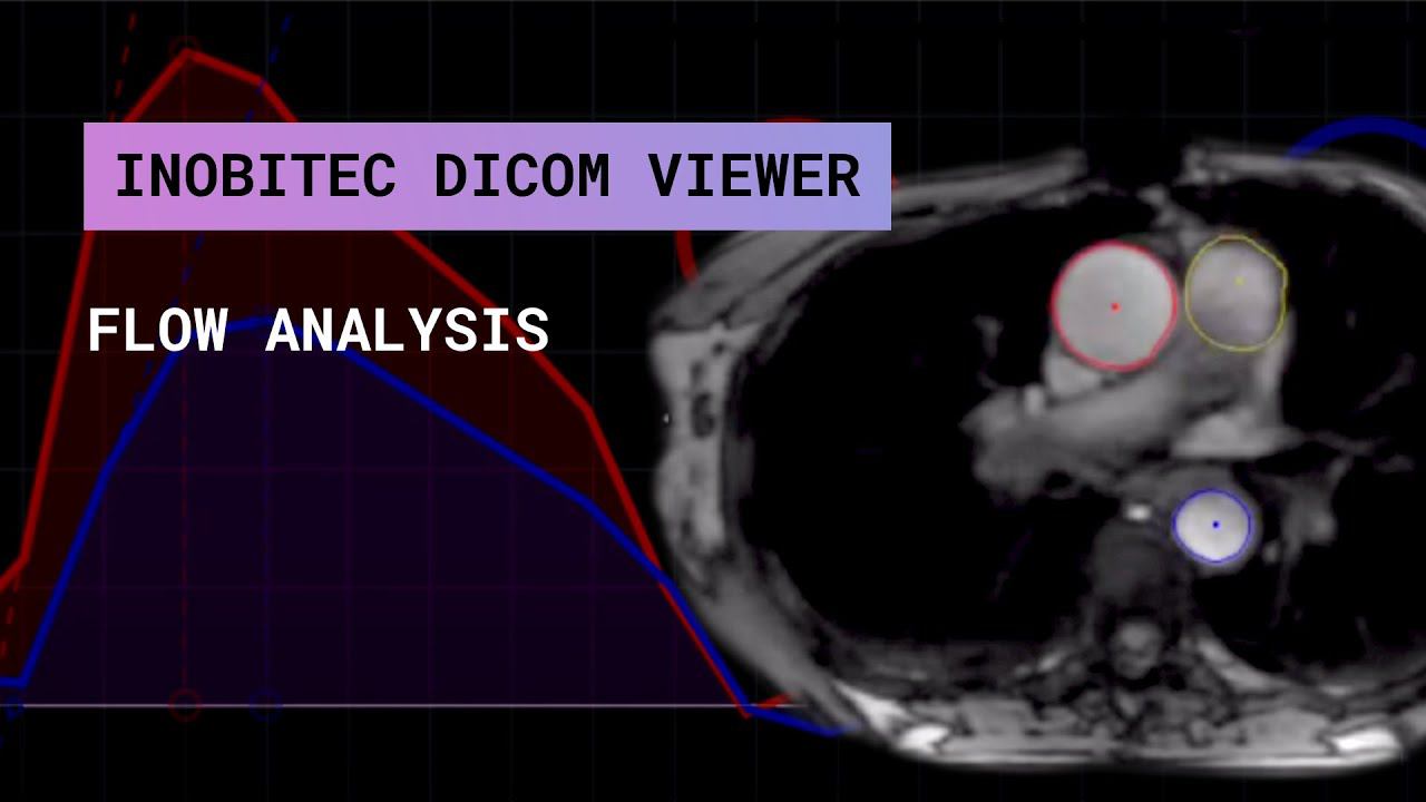 Анализ потока с помощью Inobitec DICOM Viewer Pro