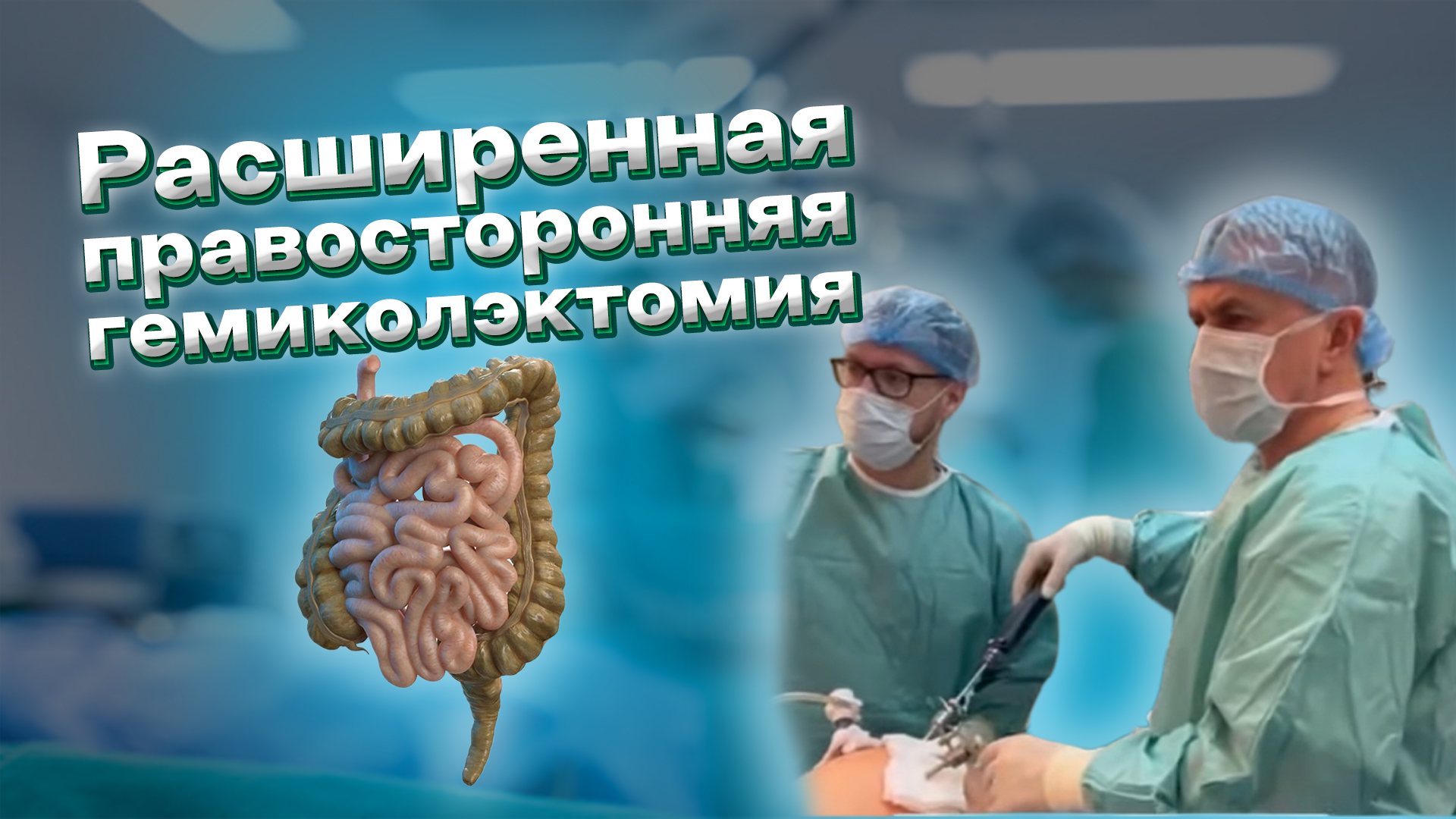 Расширенная правосторонняя гемиколэктомия