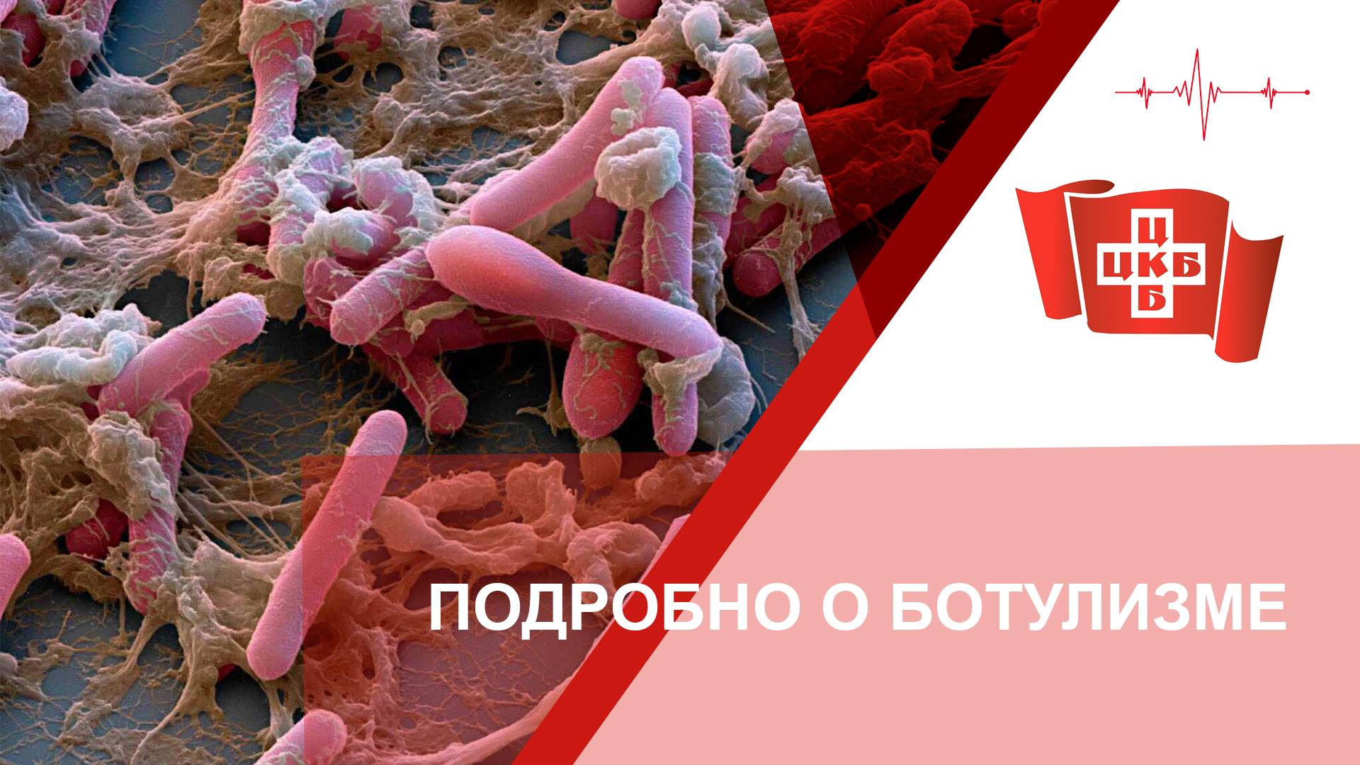 Подробно о ботулизме