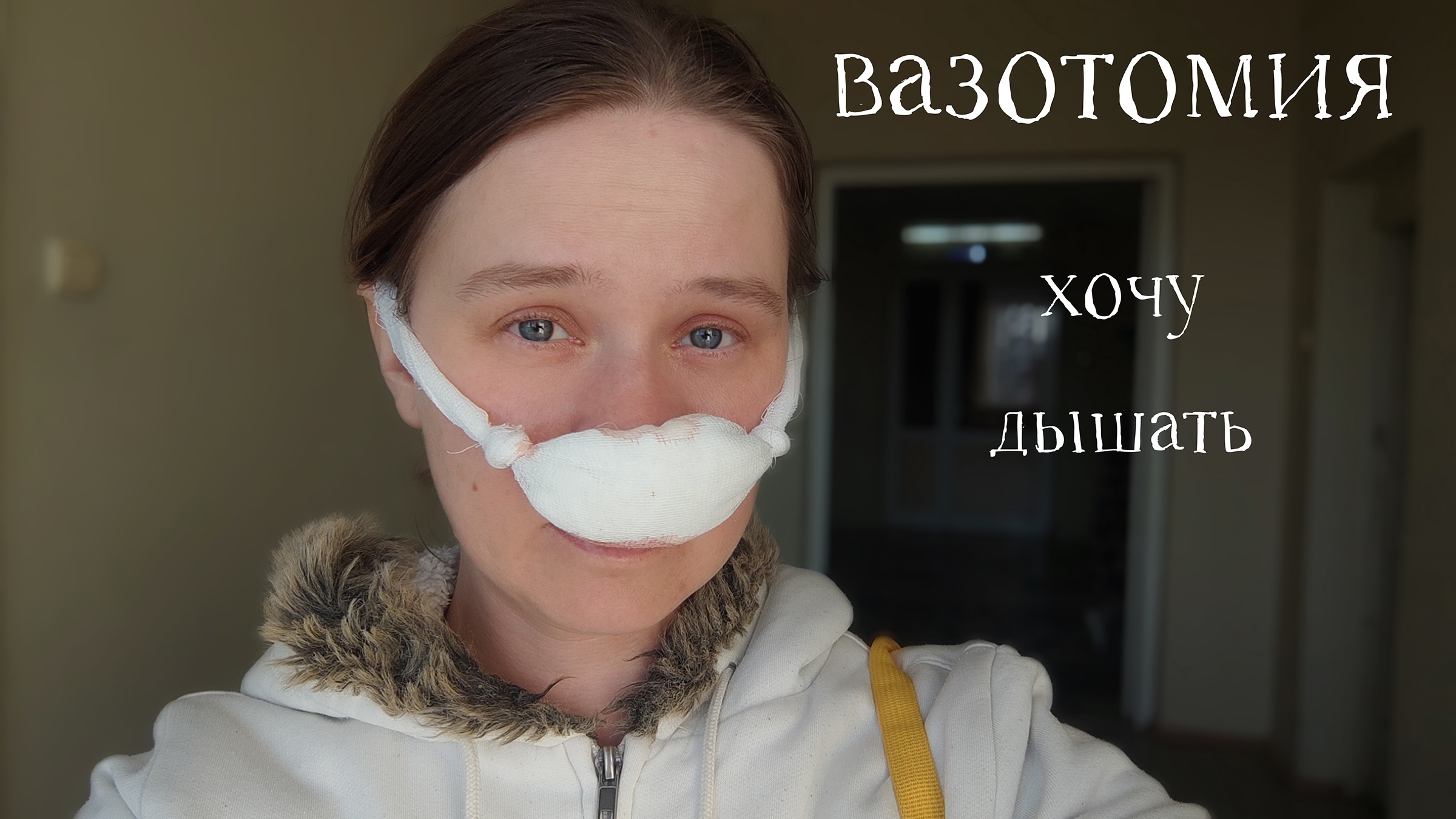 Я это сделала. Оперативное лечение вазомоторного ринита. Вазотомия.