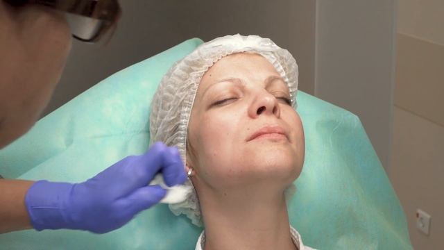 Биоревитализация и коррекция носогубных складок препаратами Restylane