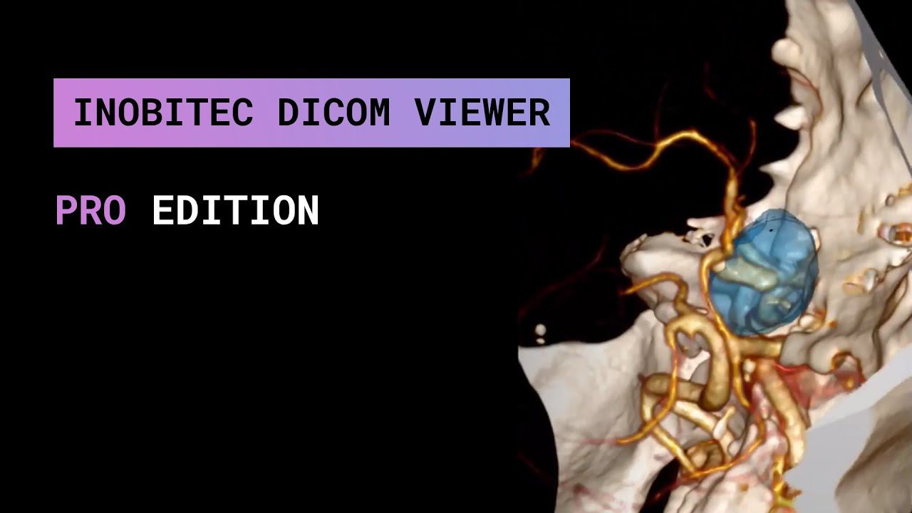 Inobitec DICOM-Просмотрщик в редакции Pro для Telegram-канала NEURAHIM