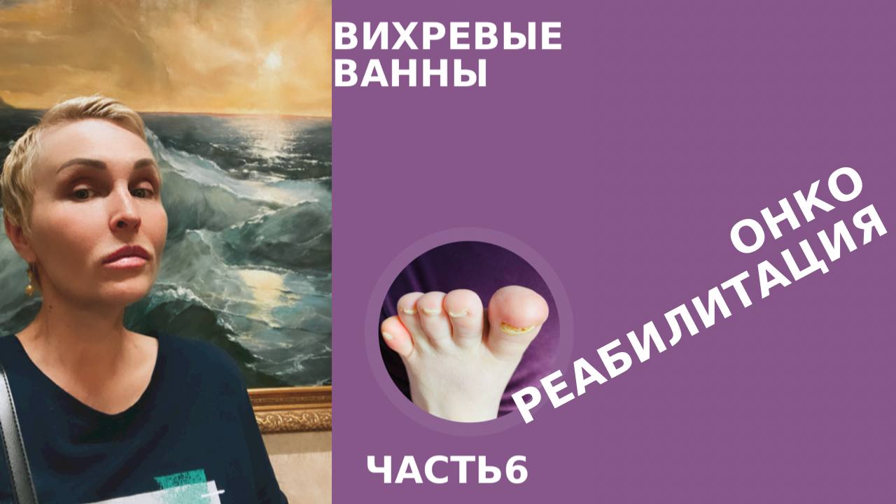 РЕАБИЛИТАЦИЯ ПРИ ОНКОЛОГИИ часть 6 ЭТА ПРОЦЕДУРА ПРИГОДИЛАСЬ БЫ В НАЧАЛЕ ХИМИОТЕРАПИИ