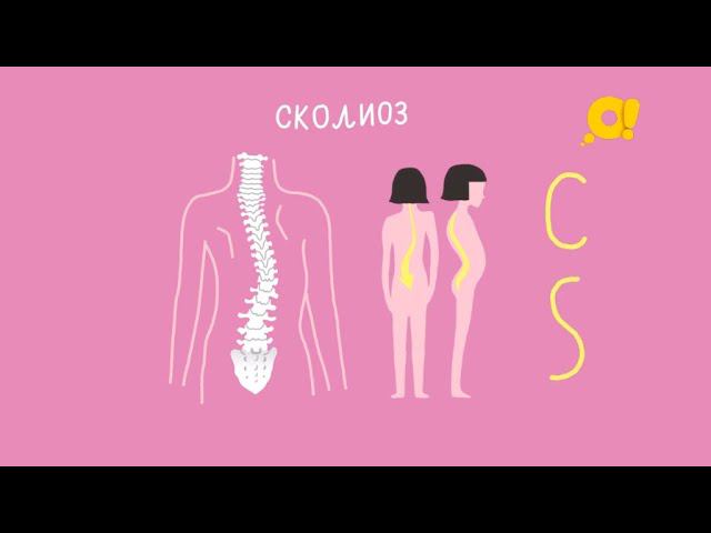 Доктор Малышкина. Сколиоз. Профилактика и коррекция нарушений осанки