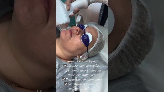 Процесс процедуры лазерного омоложения лица