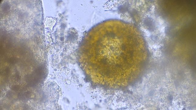 Амеба (цисты в экскрементах сома)