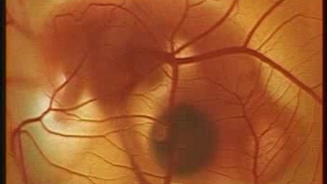 РАЗВИТИЕ ЗАРОДЫША КУРИЦЫ