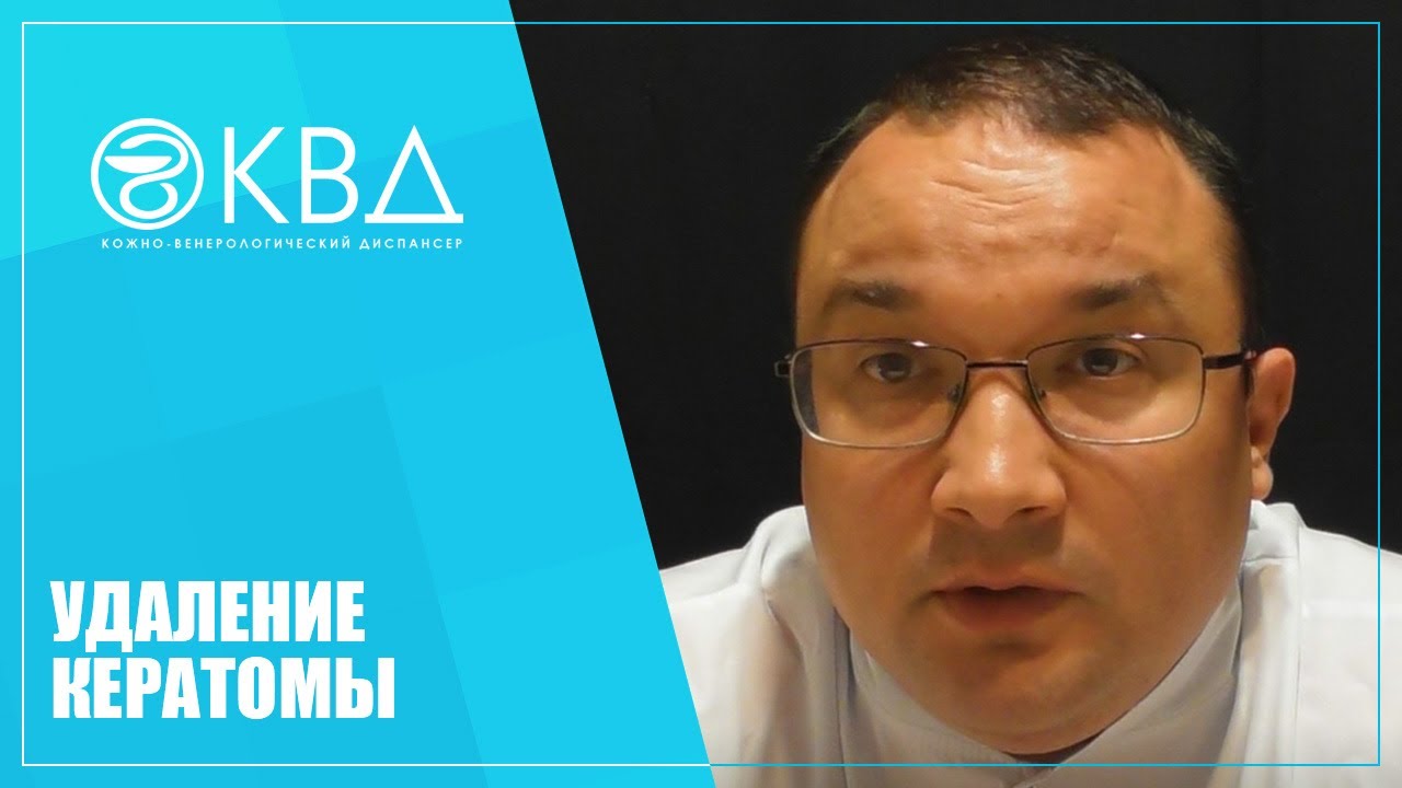 1246  Удаление кератомы